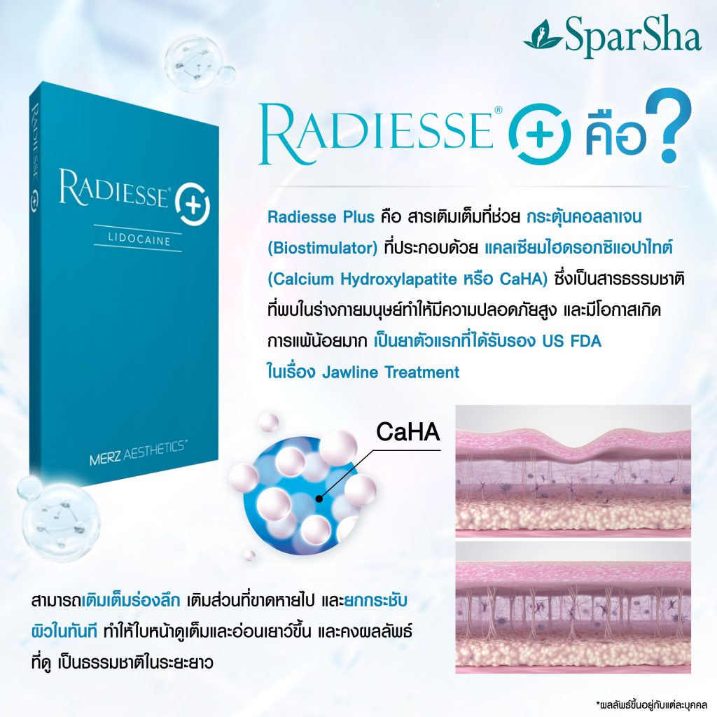 SparSha Thailand - Radiesse Plus สารฉีดปรับกรอบหน้า ทำให้ได้รูปหน้าที่ดูเรียวสวย